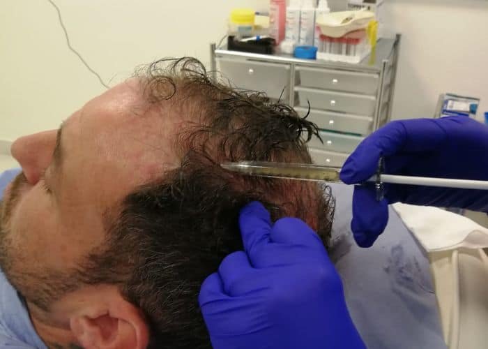 PRP Training - Pharma Aesthetics Academy